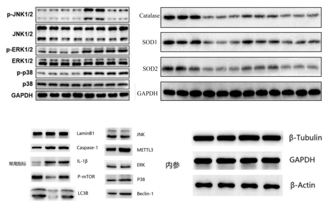 超强干货丨一文看懂WB、qPCR生物测试，内含常见问题（附答案）-测试狗·科研服务